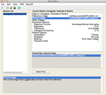 Co-Registering 3D Rendering Visualizing And Area Labeling Ecog Strip ...